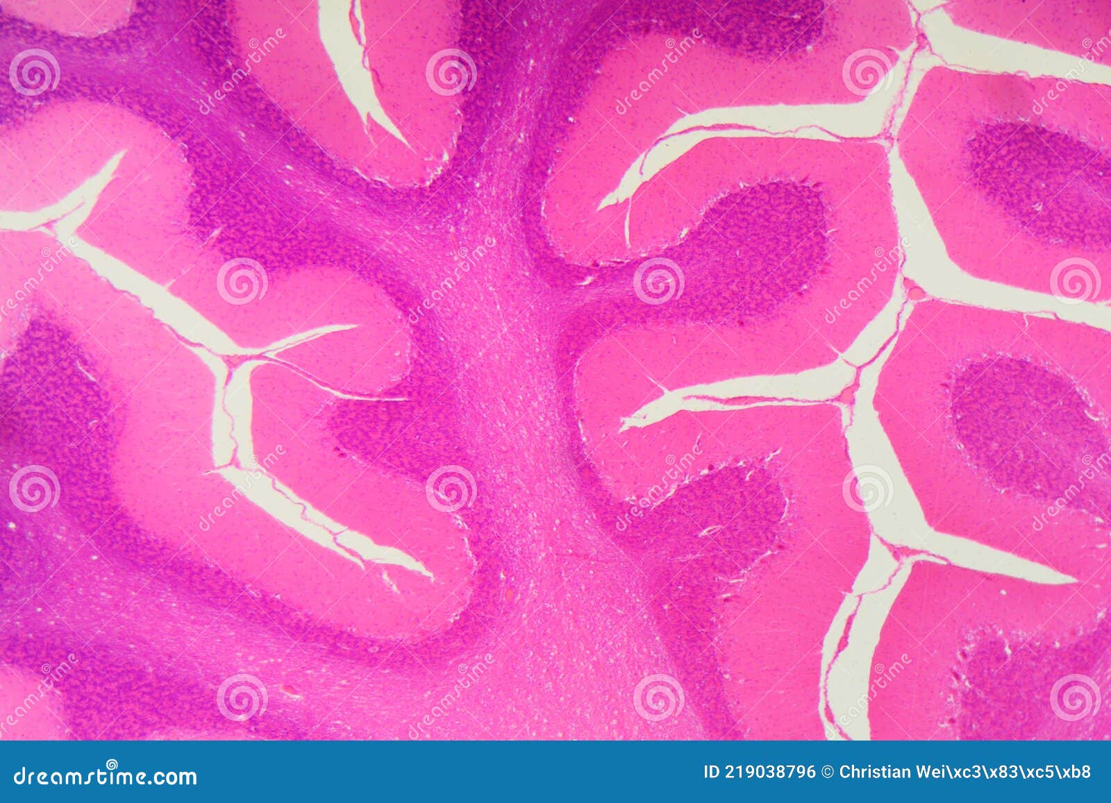 Human Cerebellum Under the Microscope Stock Photo - Image of medicals ...