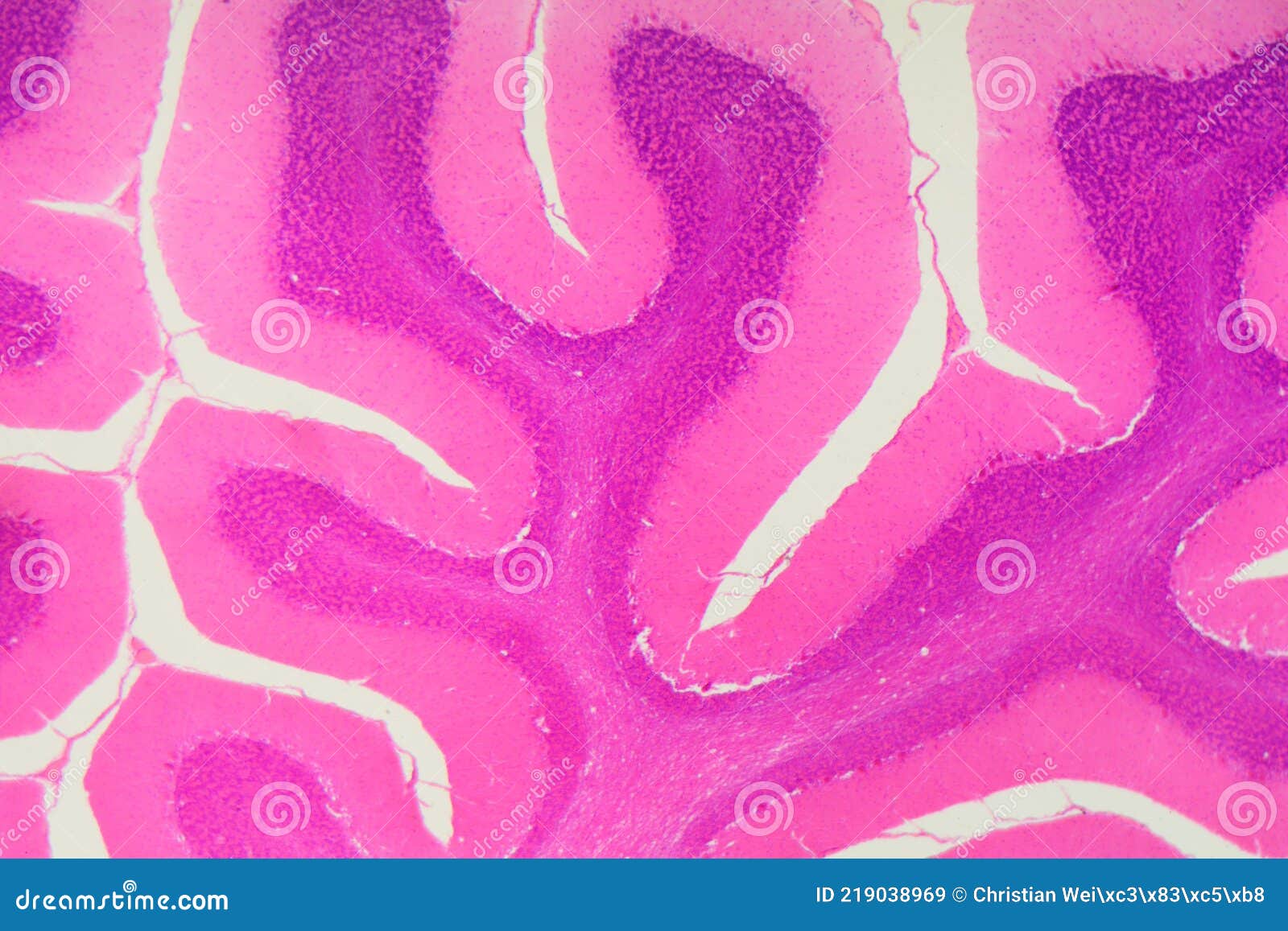 Human Cerebellum Under The Microscope Royalty-Free Stock Photography ...