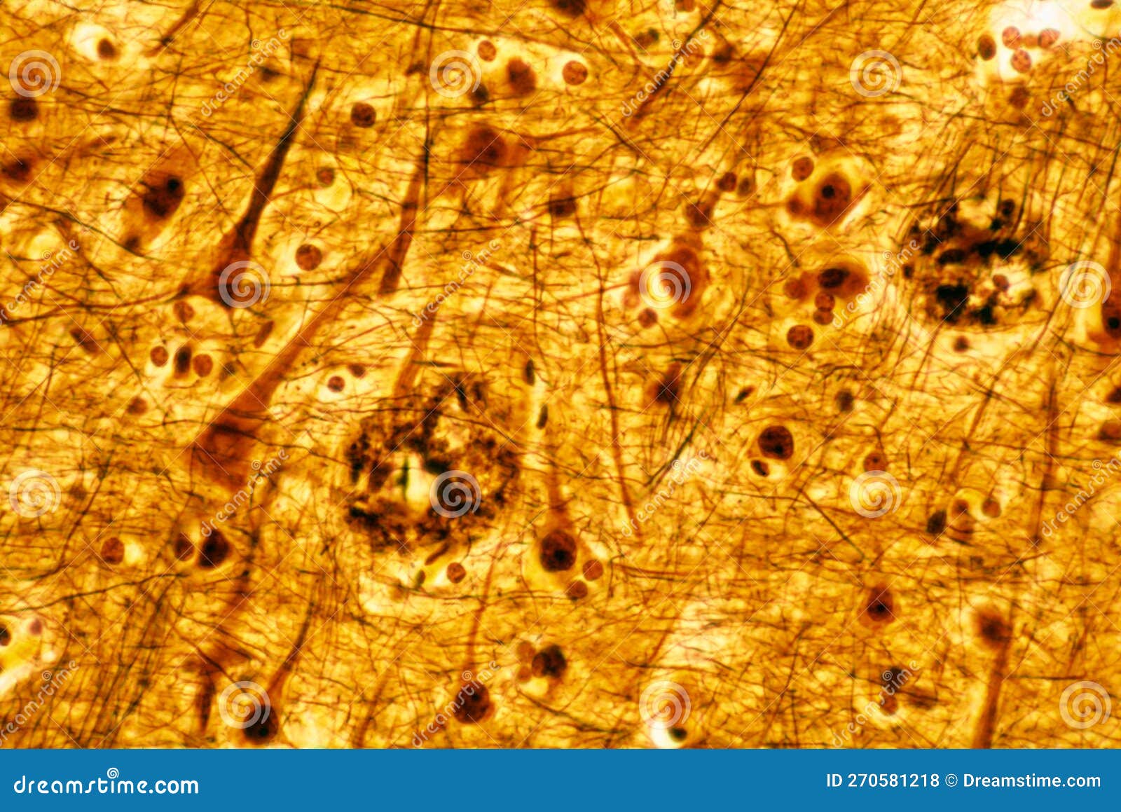 Cerebral Cortex. Pyramidal Neurons Royalty-Free Stock Photo ...