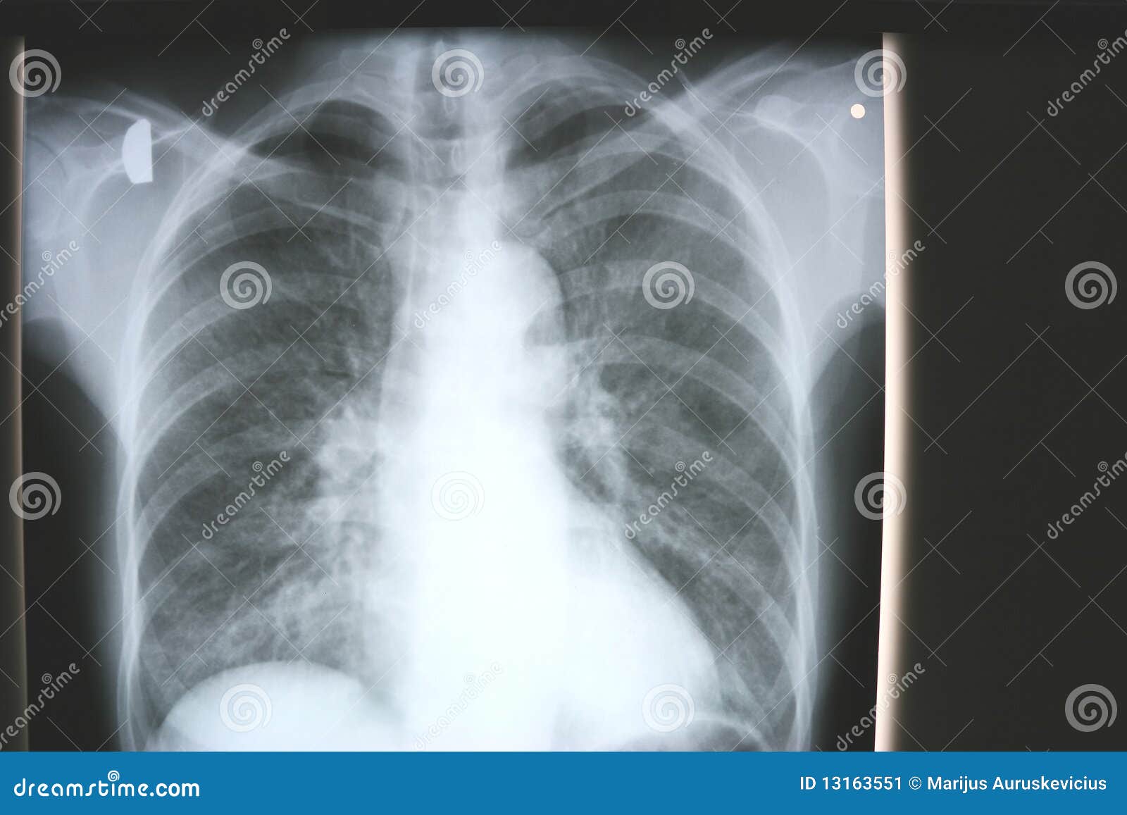 Human chest stock image. Image of doctor, exam, center - 13163551