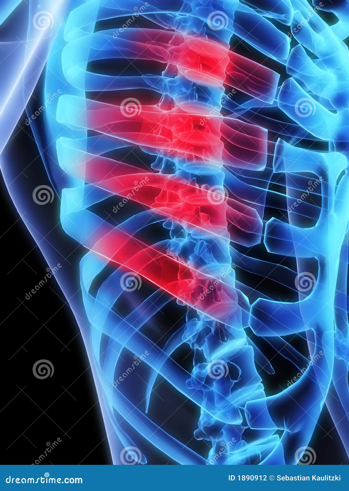 Human chest stock illustration. Illustration of anatomical - 1890912