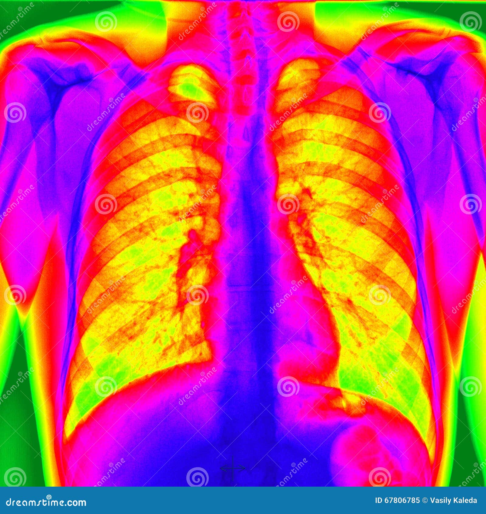 Human chest stock image. Image of bronchus, anterior - 67806785