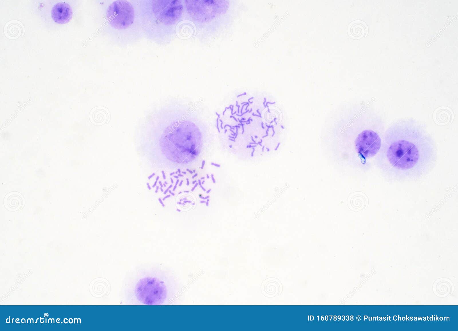 Human Chromosomes from Blood Under Microscope View Stock Photo - Image ...