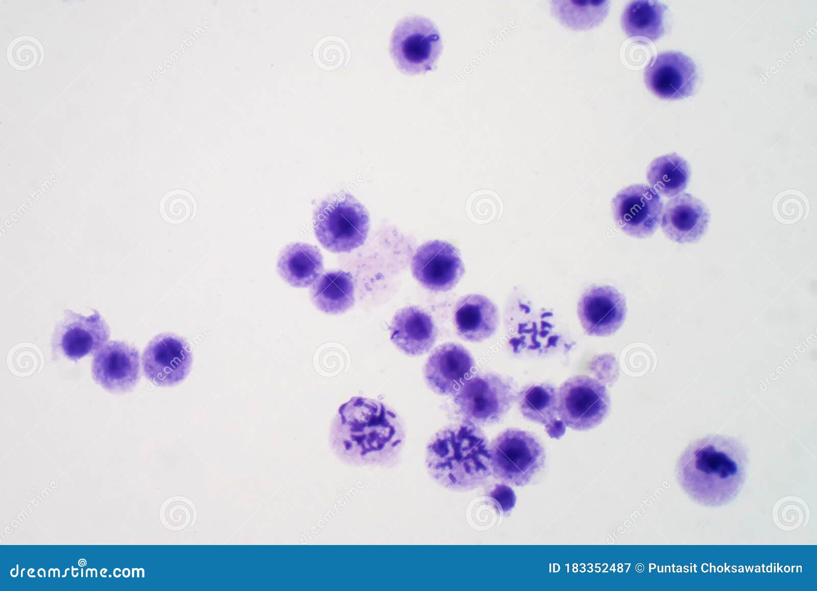 Human Chromosomes from Blood Under Microscope View Stock Image - Image ...