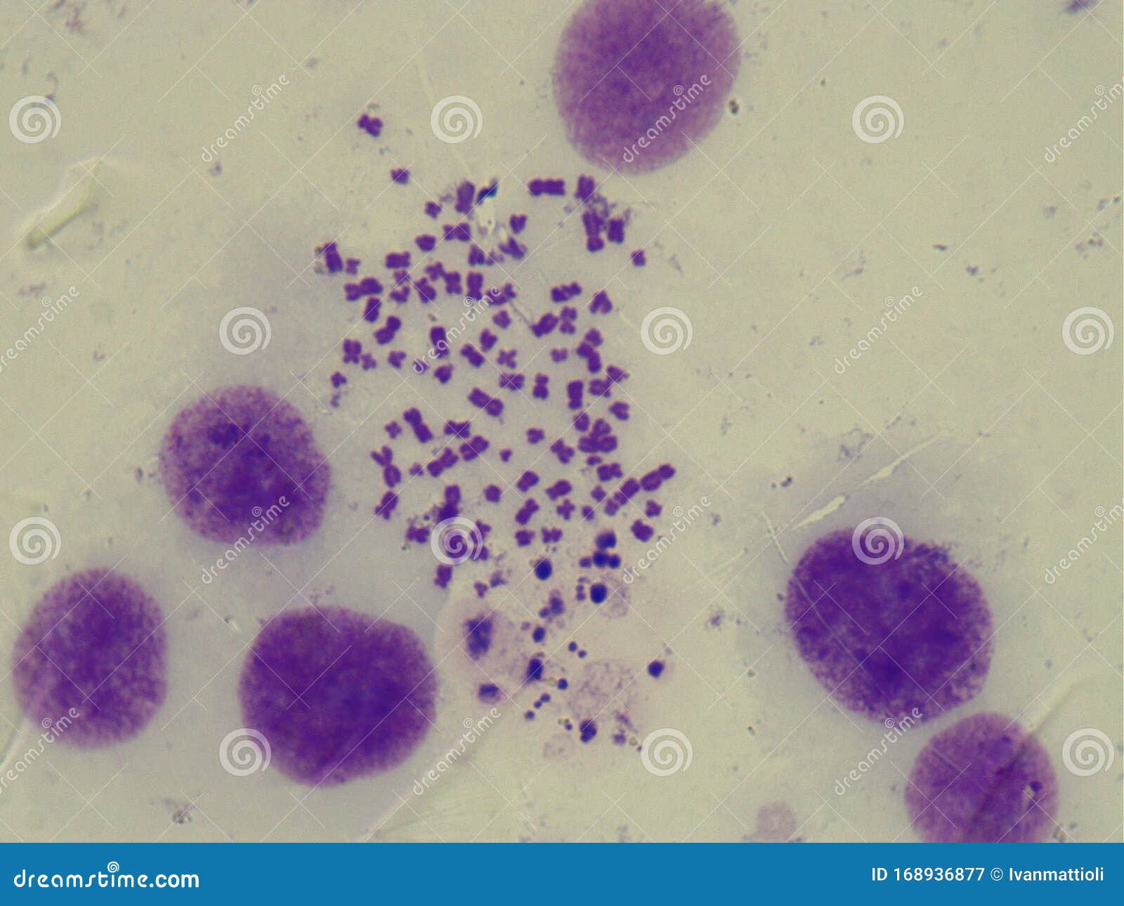 Human Chromosomes Under Light Microscope. 1000x Magnification Stock ...