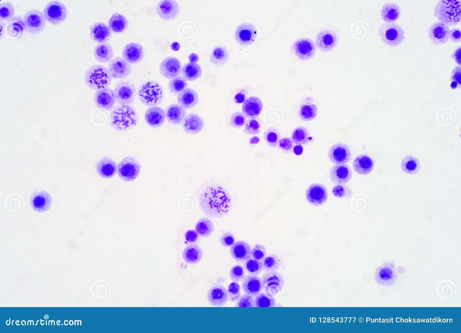 Human Chromosomes Under Microscope View Stock Image - Image of anatomy ...