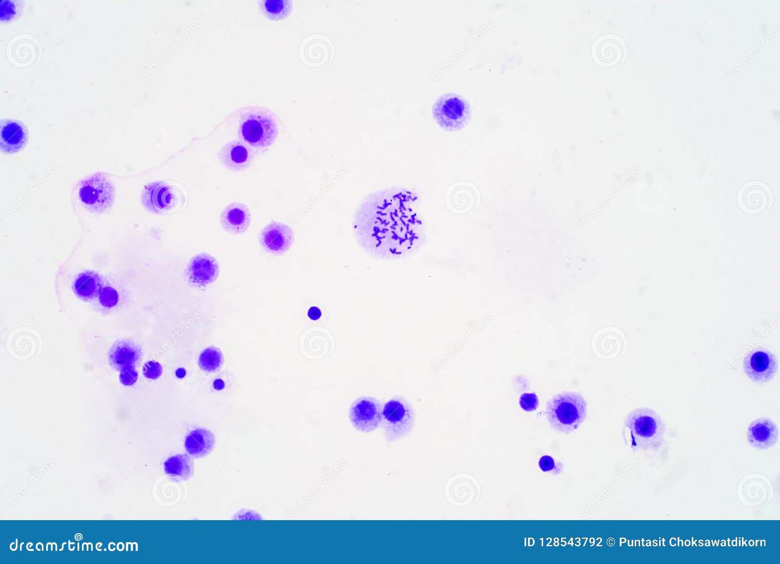 Human Chromosomes Under Microscope View Stock Photo - Image of design ...