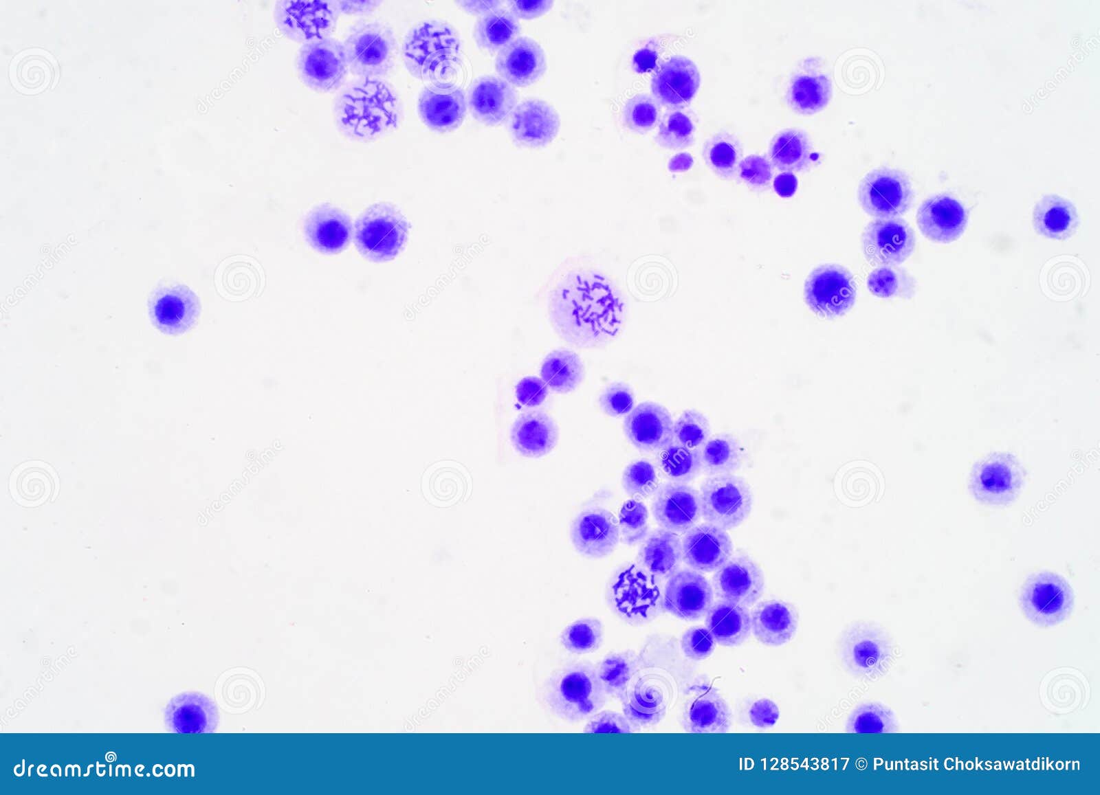 Human Chromosomes Under Microscope View Stock Image - Image of abstract ...
