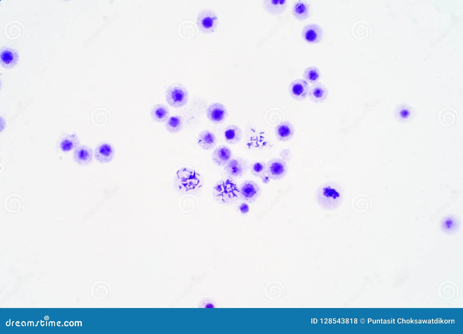 Human Chromosomes Under Microscope View Stock Photo - Image of ...