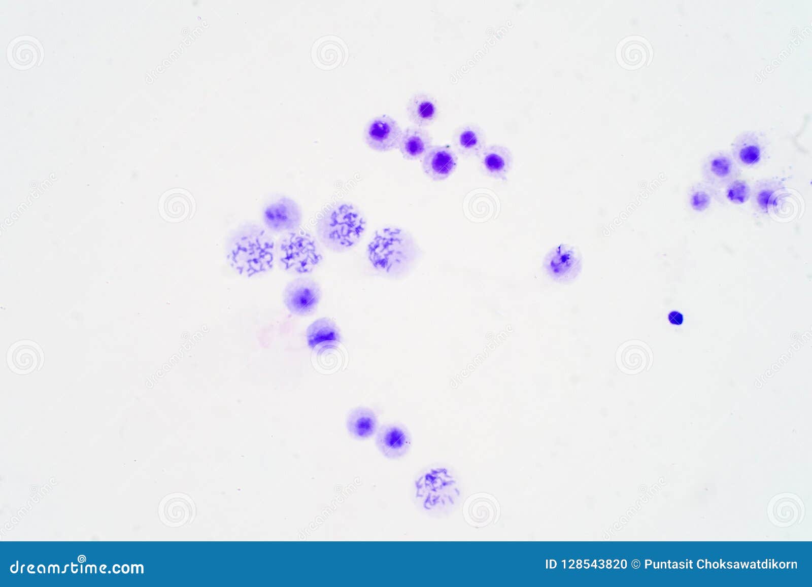 Human Chromosomes Under Microscope View Stock Photo - Image of life ...