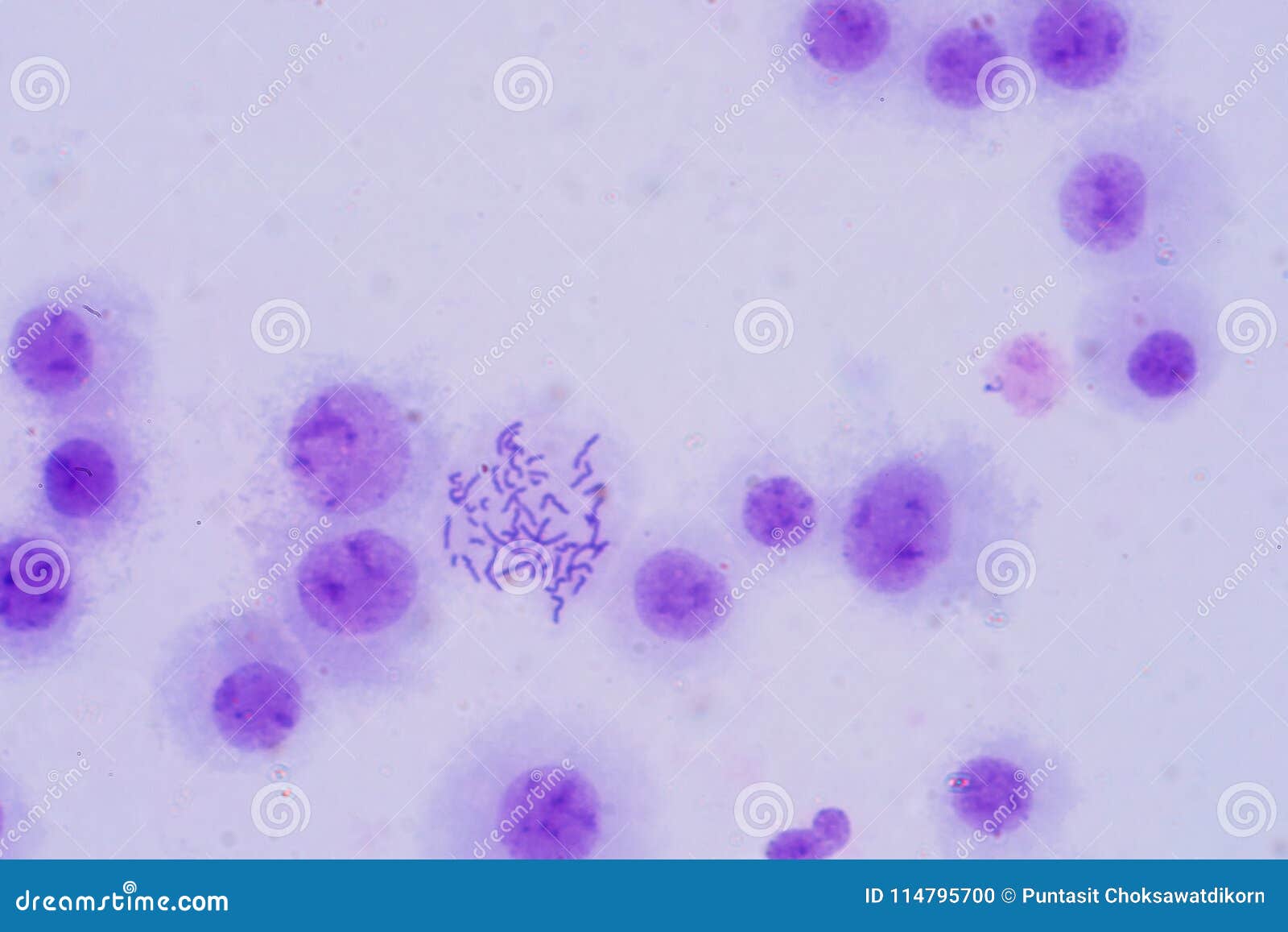 Human Chromosomes Under Microscope View Stock Photo - Image of anatomy ...