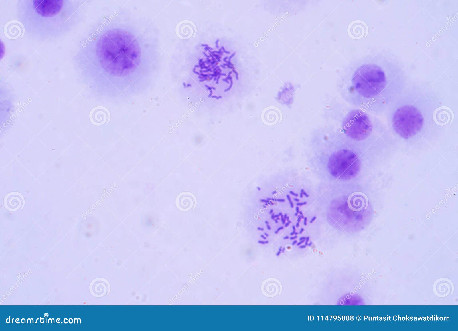 Human Chromosomes Under Microscope View Stock Photo - Image of abstract ...