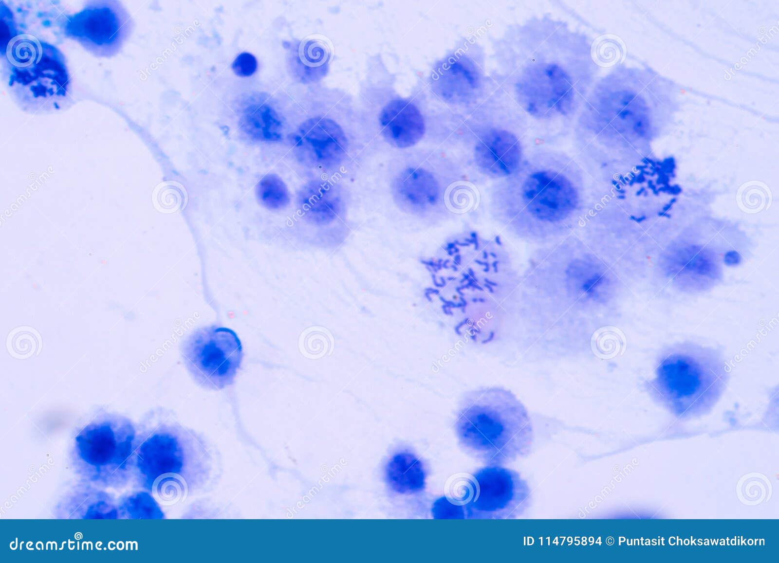 Human Chromosomes Under Microscope View Stock Photo - Image of macro ...