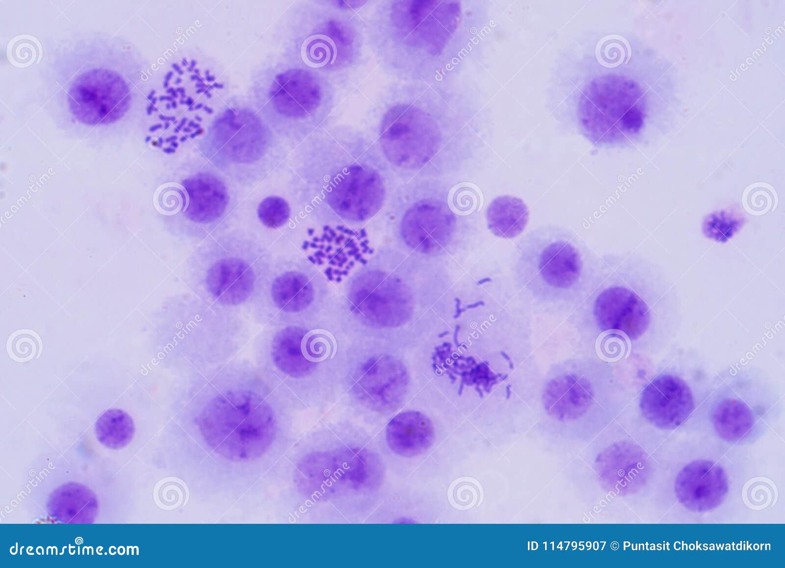 Human Chromosomes Under Microscope View Stock Image - Image of ...