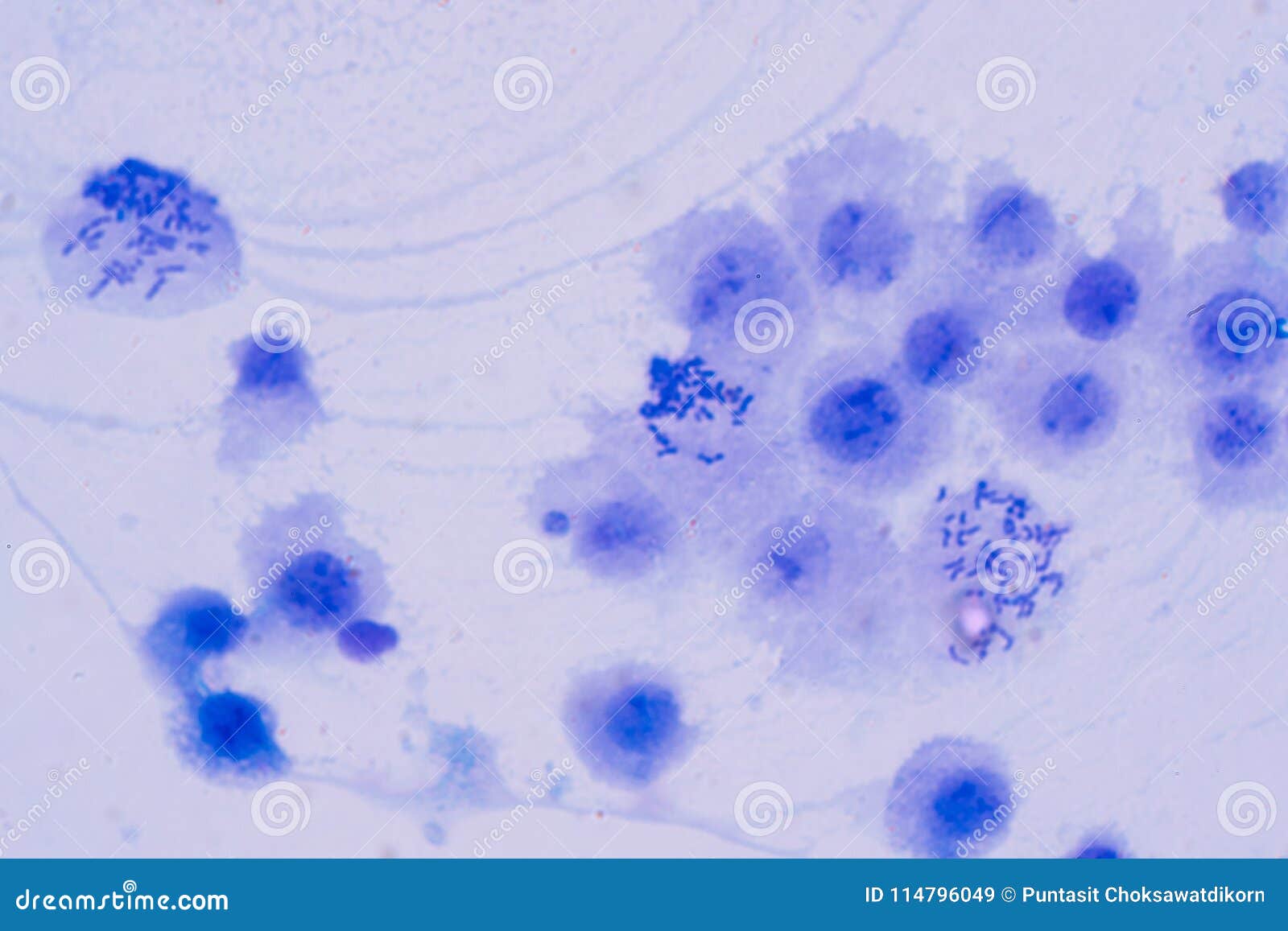 Human Chromosomes Under Microscope View Stock Image - Image of chemical ...