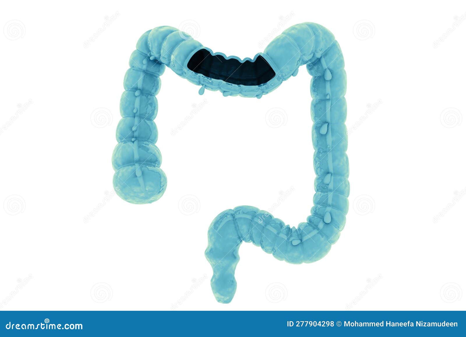 Human colon. Colon anatomy stock illustration. Illustration of bowel ...