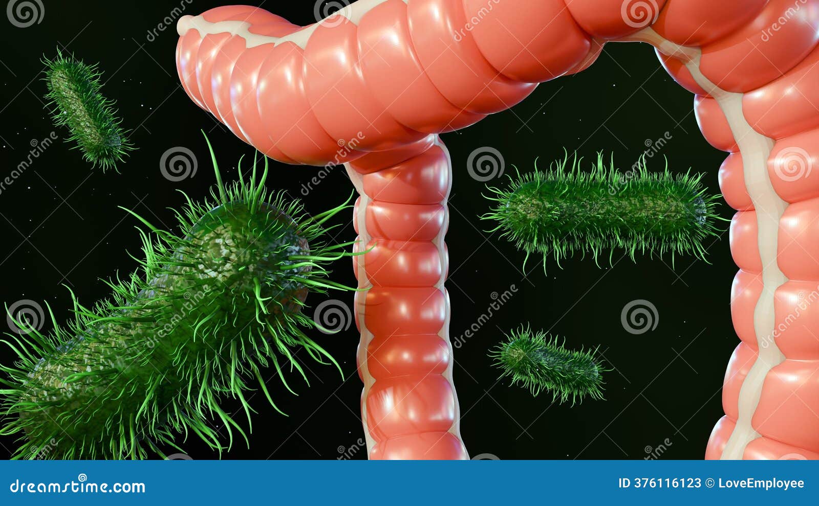 Overgrowth Of Bad Bacteria In Intestines, Inflammation In ...