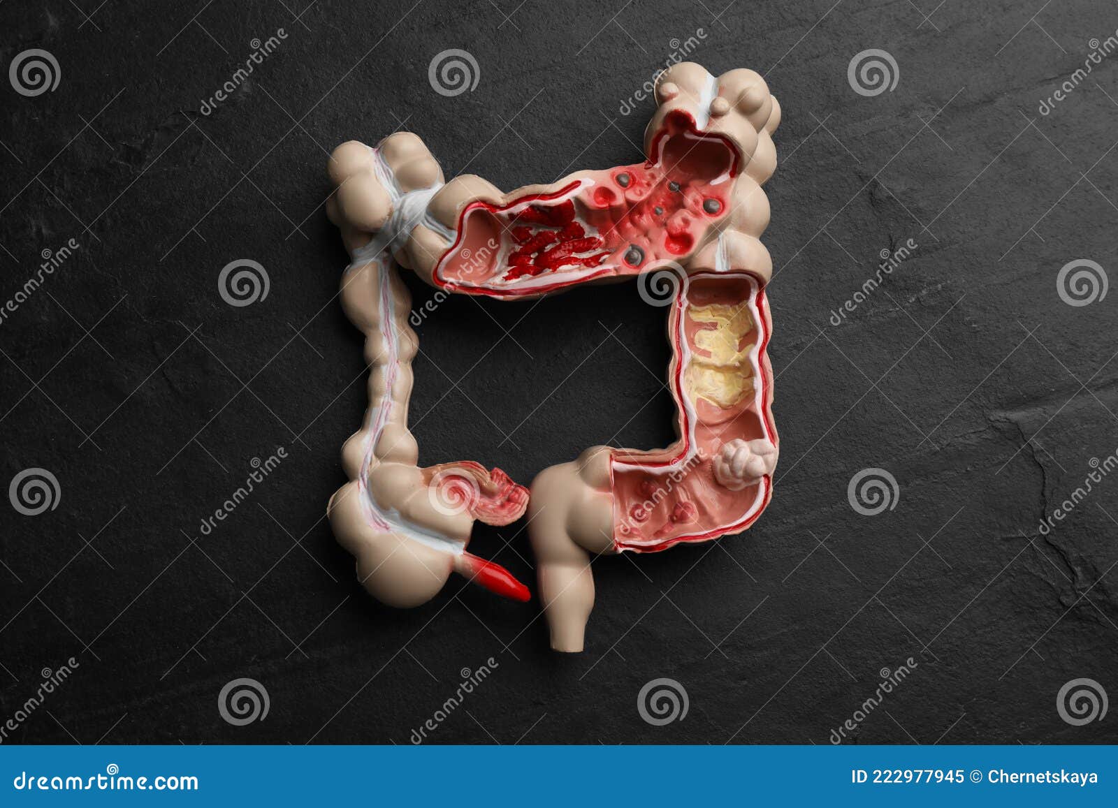 Human Colon Model on Black, Top View Stock Image - Image of department ...