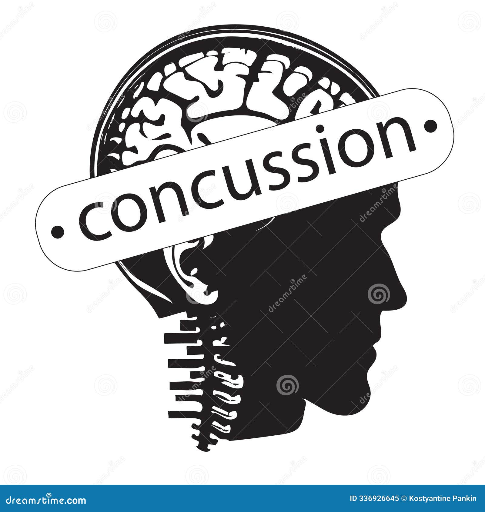 Human concussion symbol stock illustration. Illustration of white ...