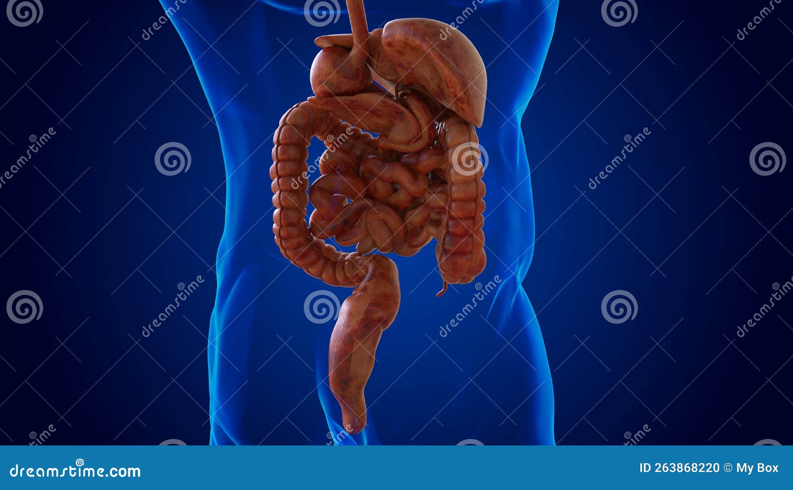 Human Damaged Digestive System for Medical Concept 3D Stock ...