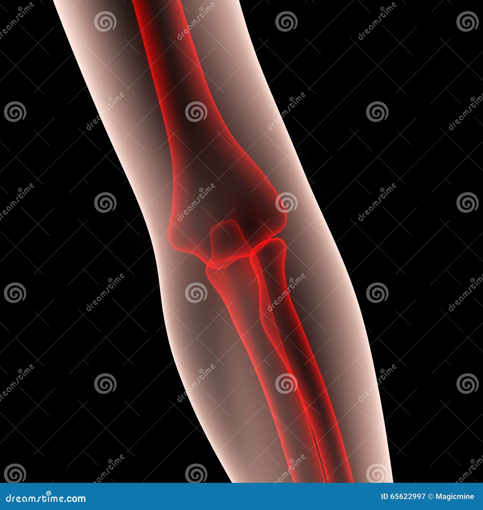 Human Elbow Joint stock illustration. Illustration of osteoporosis ...