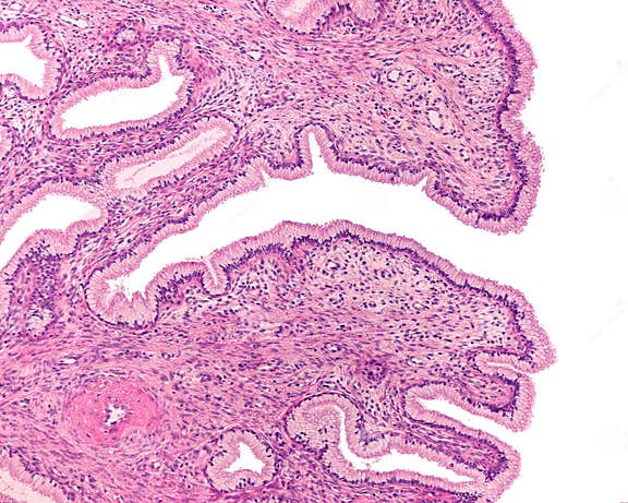 Human endocervix stock photo. Image of mucous, histology - 231620822