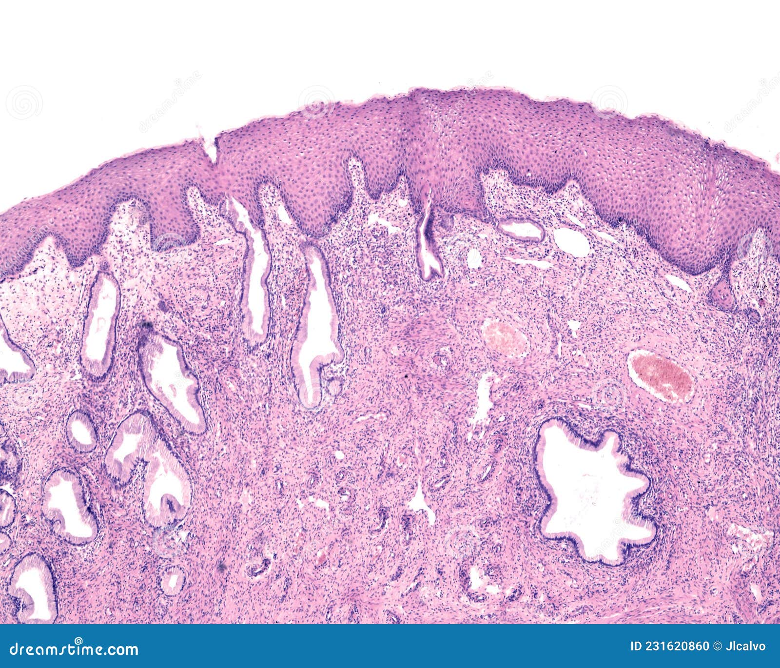 Exocervix Lining Stock Photos - Free & Royalty-Free Stock Photos from ...