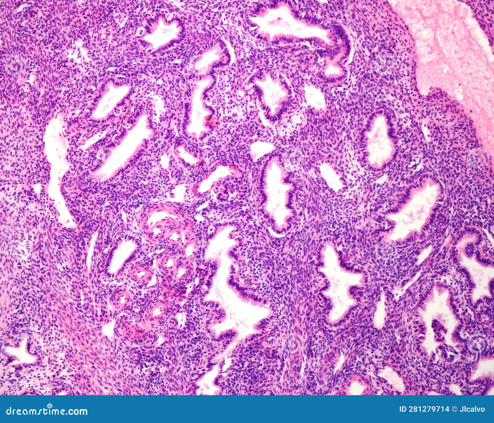 Endometrium. Secretory Phase Royalty-Free Stock Image | CartoonDealer ...