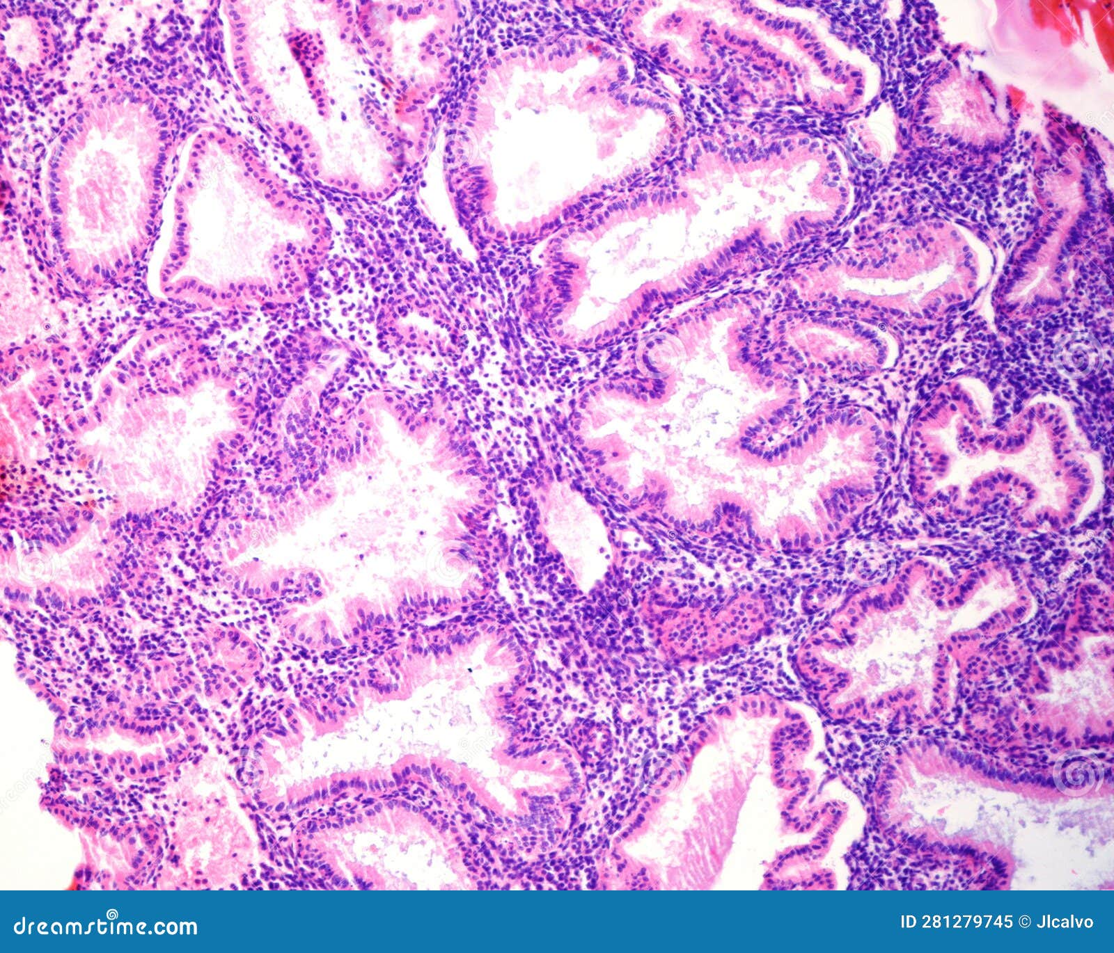 Human Endometrium. Secretory Phase Stock Image - Image of secretory ...