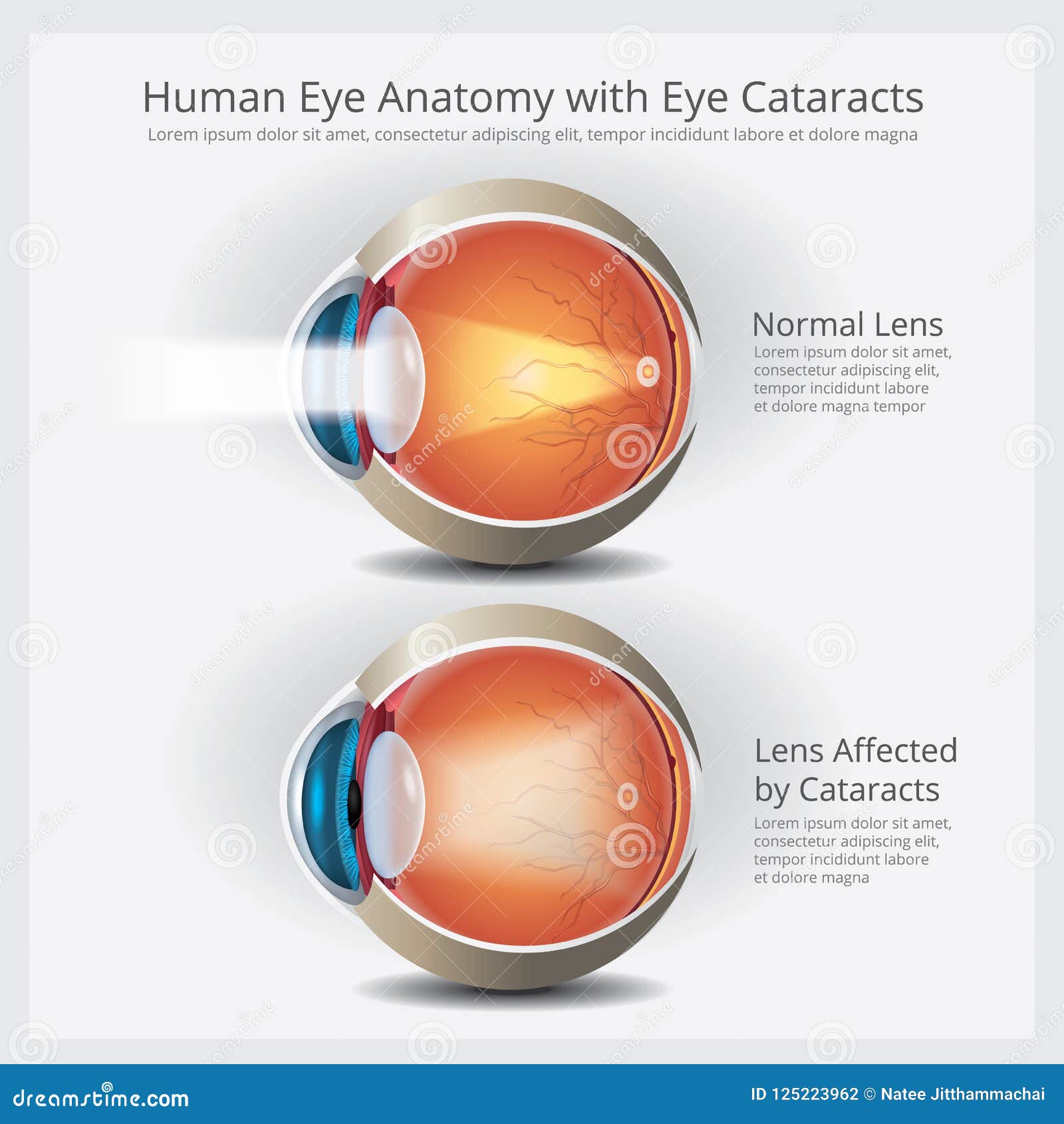 Human Normal Eye Stock Illustrations – 379 Human Normal Eye Stock ...
