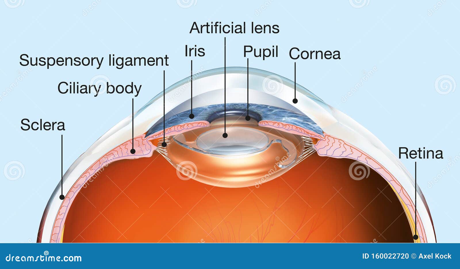 Human Eye with Artificial Lens, Labeled, Medically 3D Illustration ... Human Eye with Artificial Lens, Labeled, Medically 3D Illustration ...