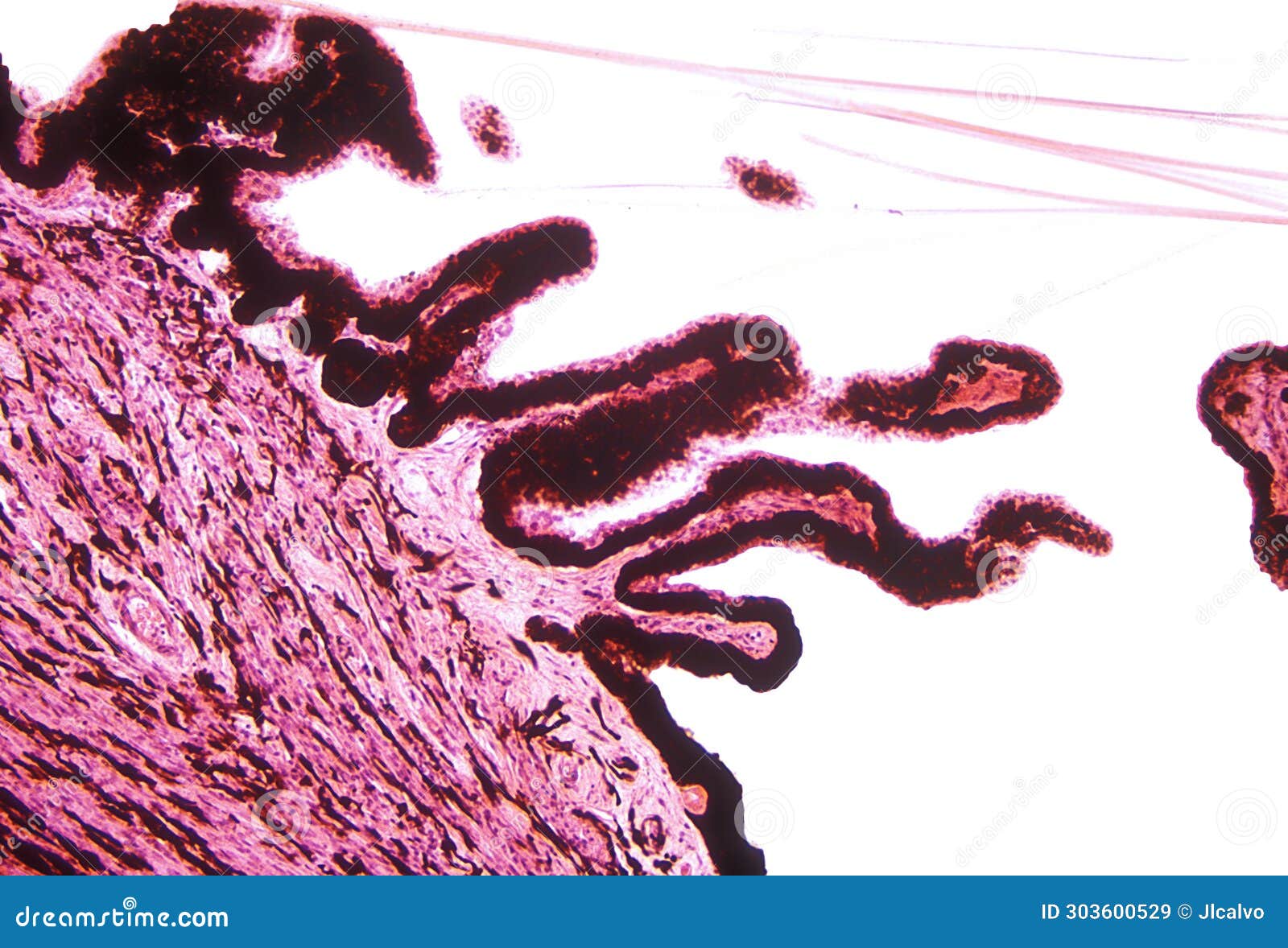 Human eye. Ciliary body stock image. Image of aqueous - 303600529