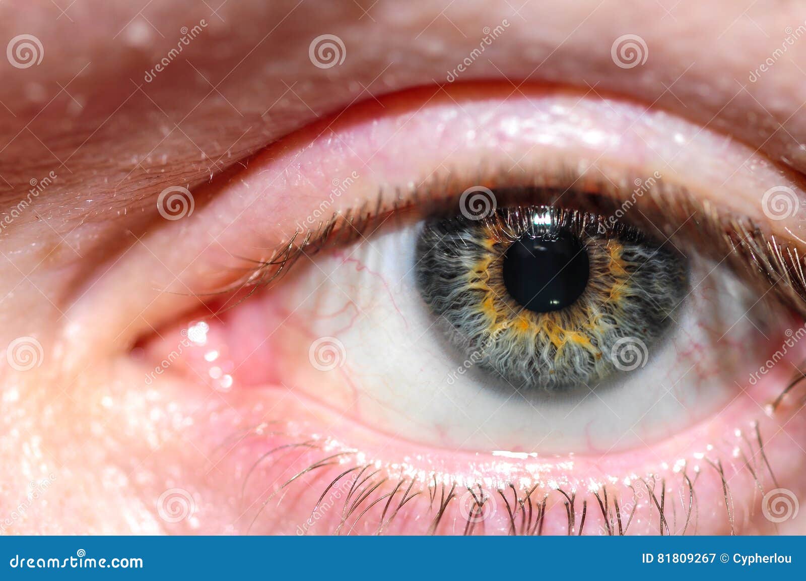 Human Eye Close Up stock image. Image of human, detailed - 81809267
