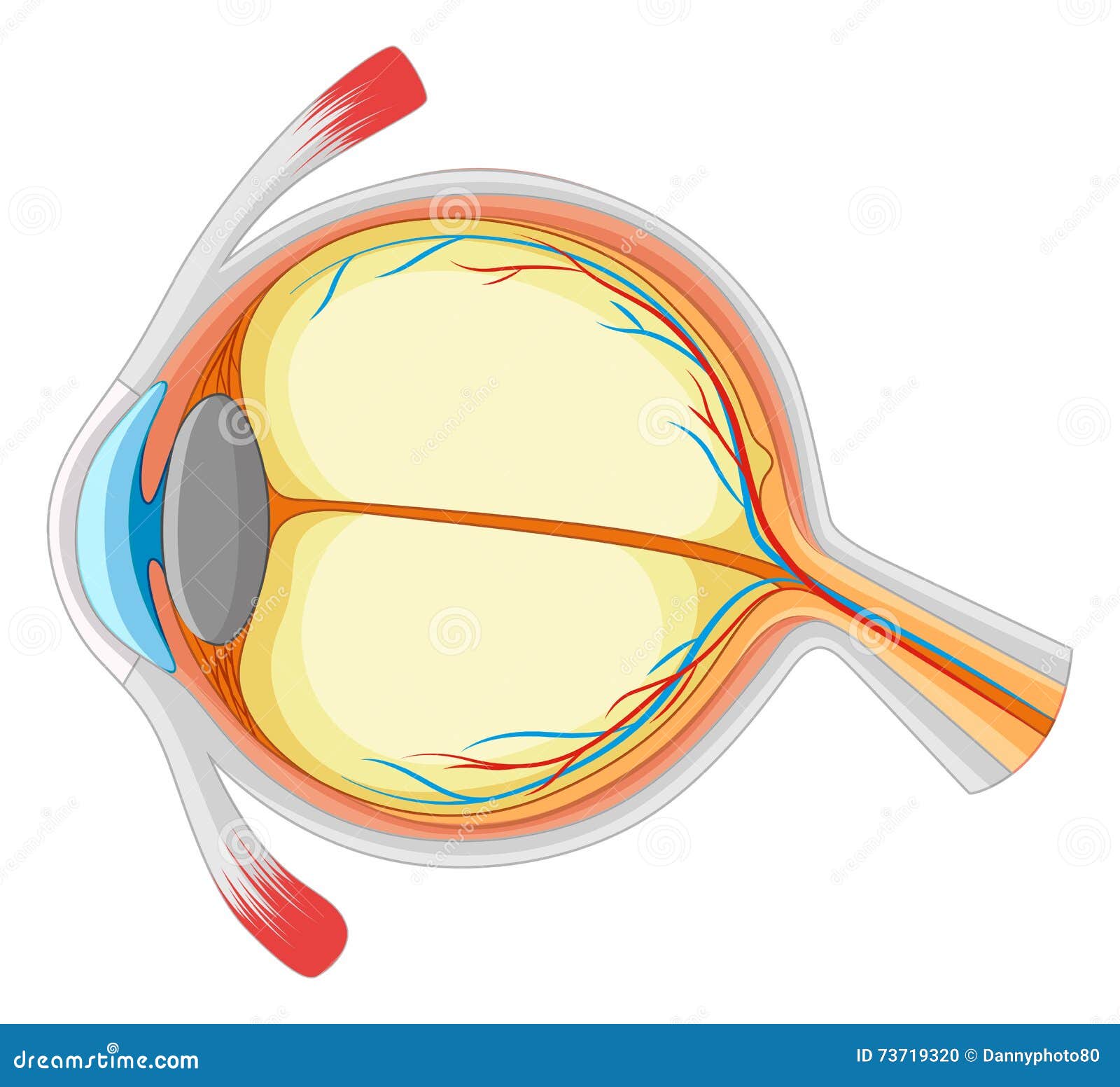 Human eye with disease stock vector. Illustration of graphic - 73719320