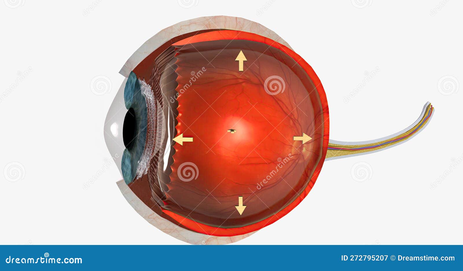 Human Eye - Glaucoma (eye Disease Stock Illustration - Illustration of ...
