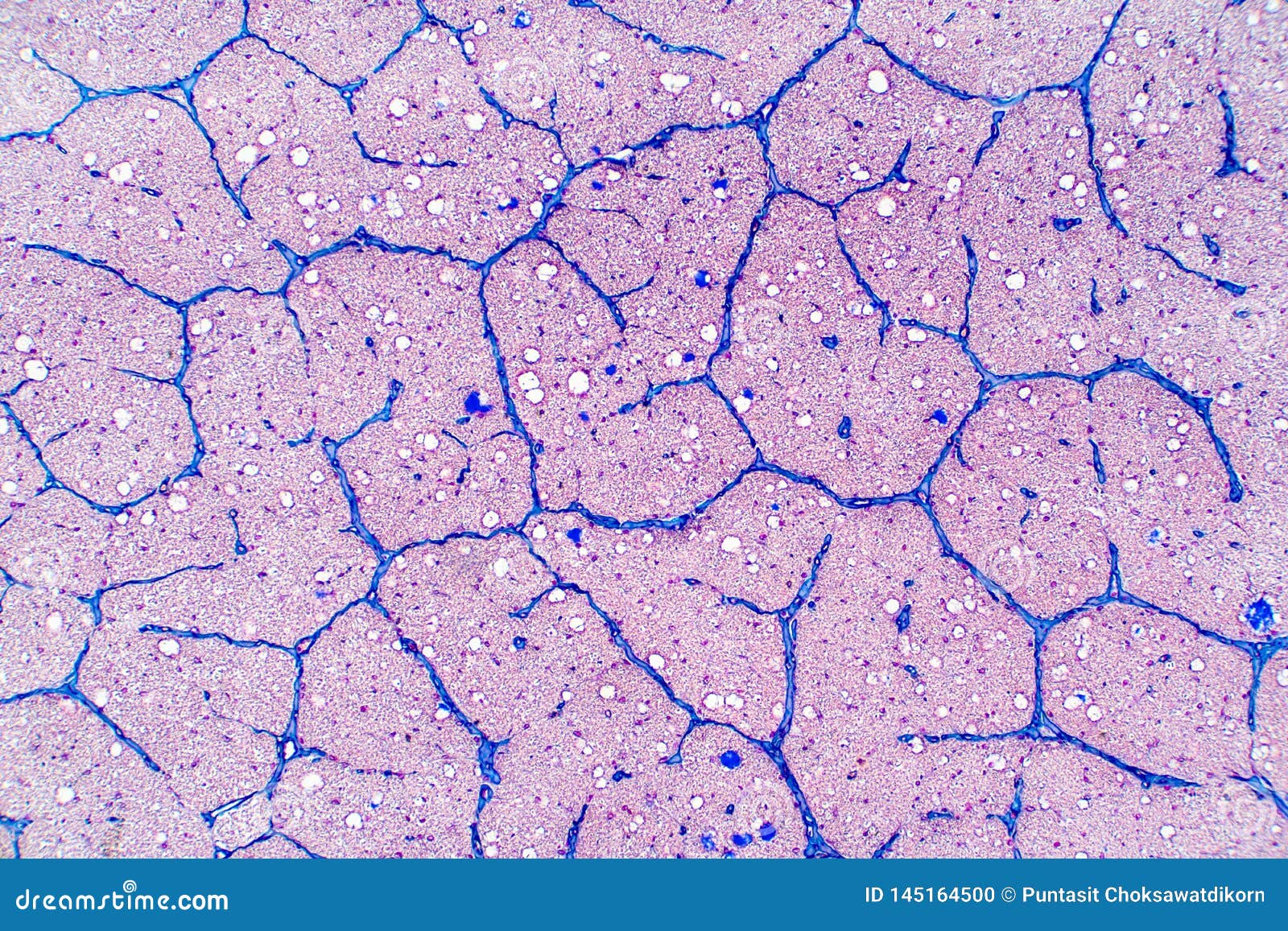 Human Eye Nerve Under the Microscope View Stock Photo - Image of ...