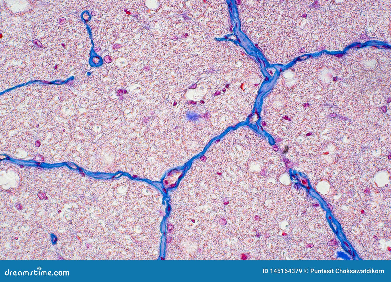 Human Eye Nerve Under the Microscope View Stock Image - Image of ...