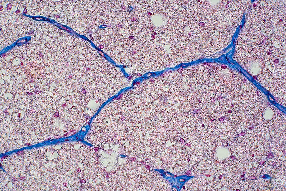 Human Eye Nerve Under the Microscope View Stock Photo - Image of lens ...