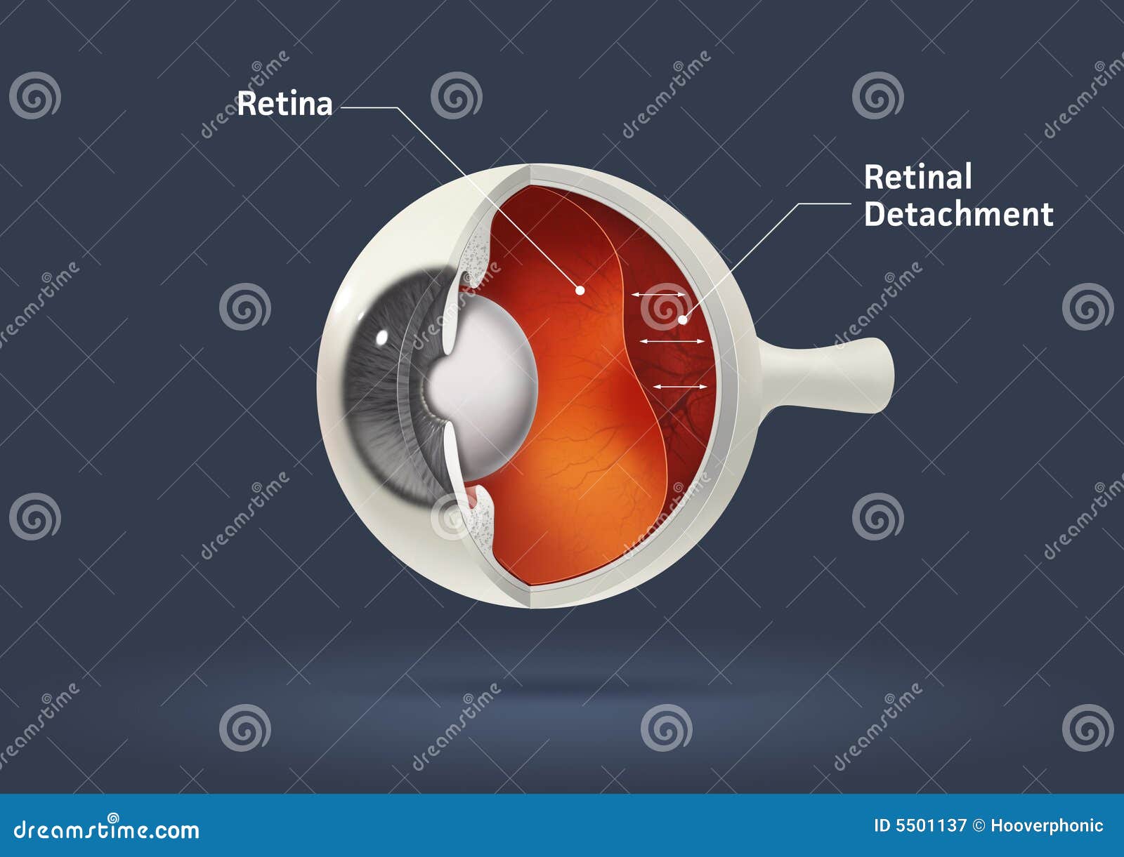 Retinal Cartoons, Illustrations & Vector Stock Images - 3559 Pictures ...
