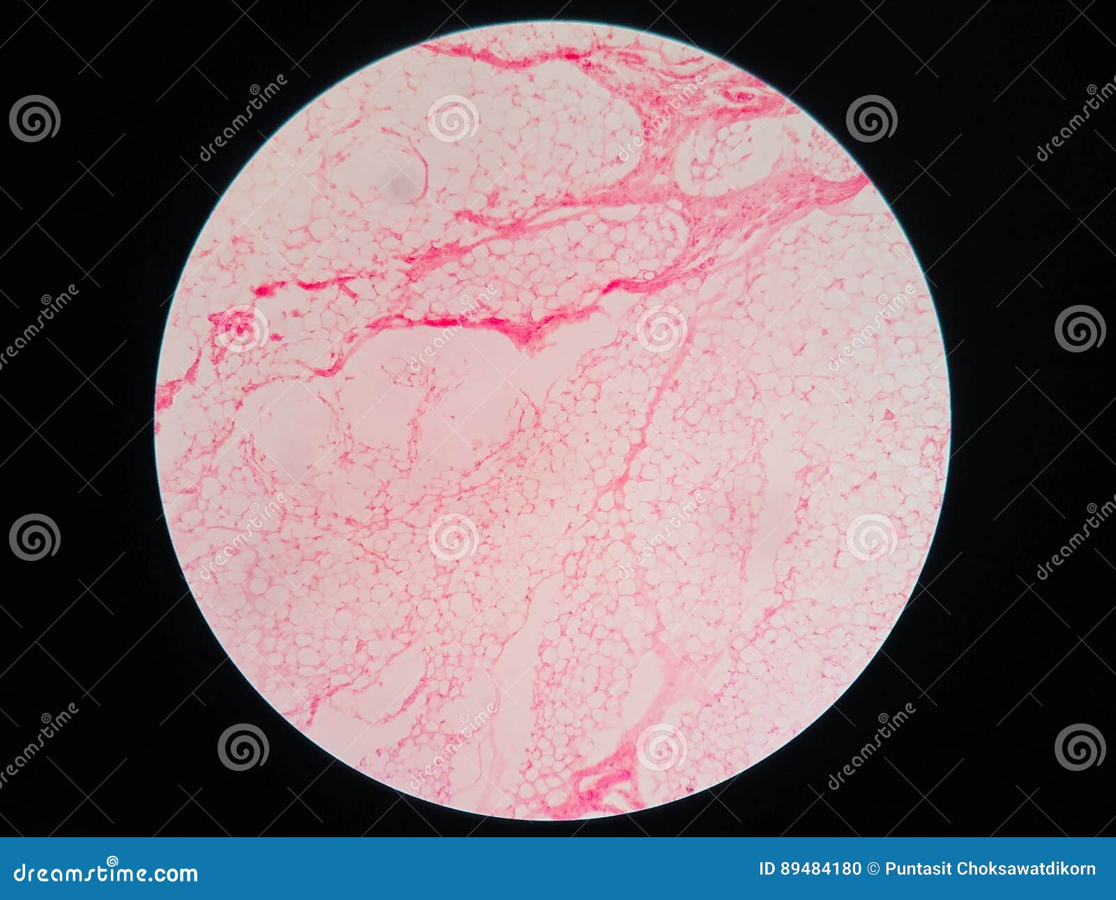 Human fat body tissue stock photo. Image of large, healthy - 89484180