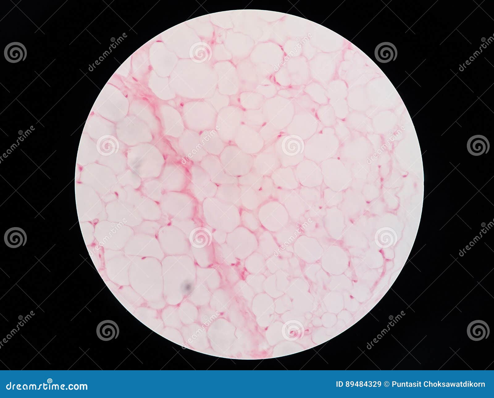 Human fat body tissue stock image. Image of lipocyte - 89484329