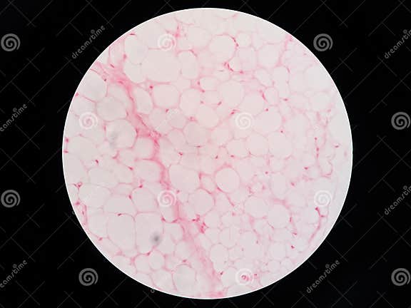 Human fat body tissue stock image. Image of lipocyte - 89484329