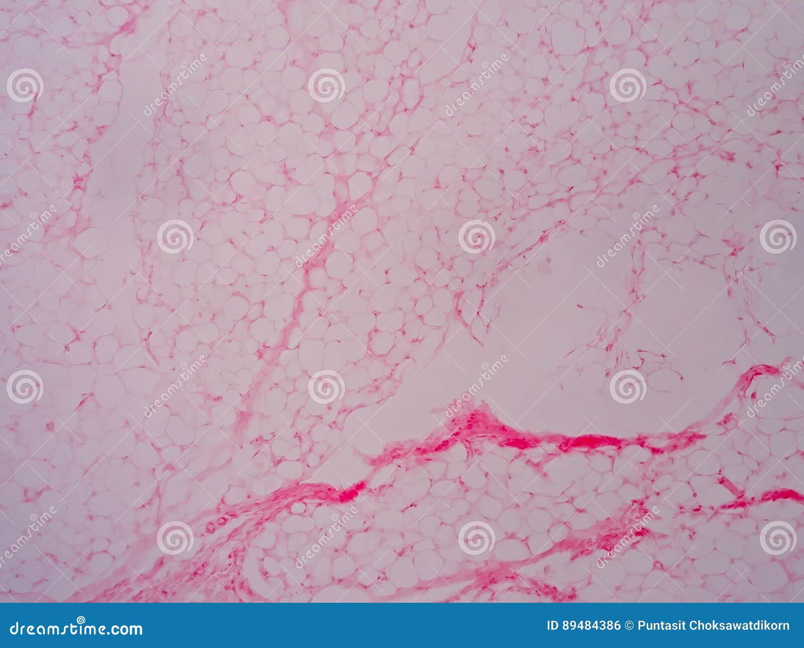 Human fat body tissue stock illustration. Illustration of dermis - 89484386