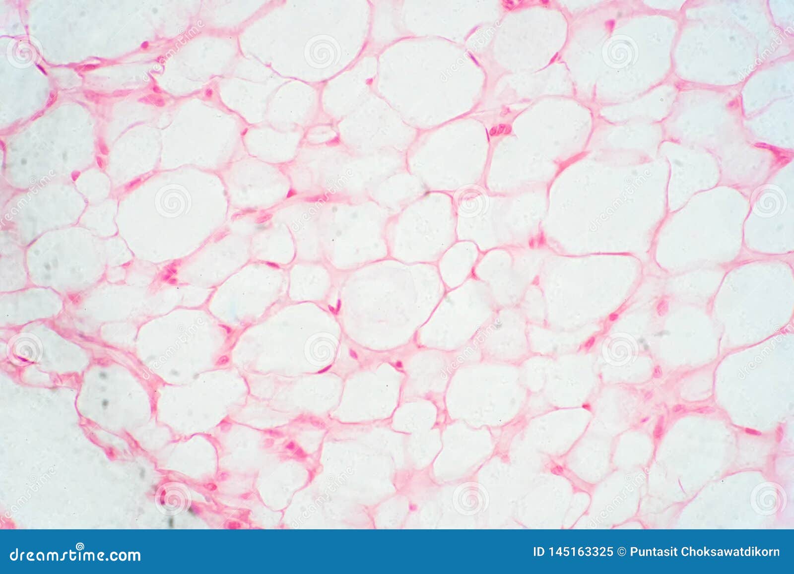 Human Fat Body Tissue Under Microscope View Stock Image - Image of ...