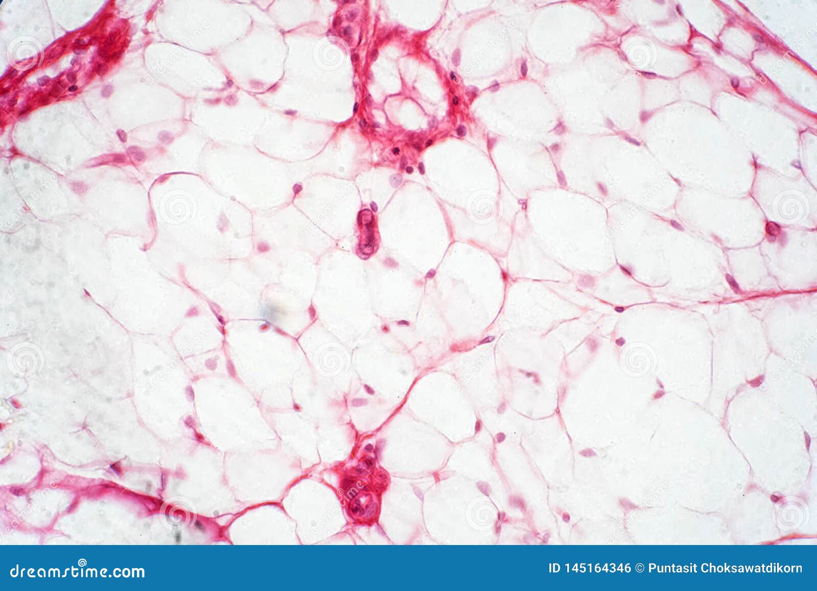 Human Fat Body Tissue Under Microscope View Stock Photo - Image of ...