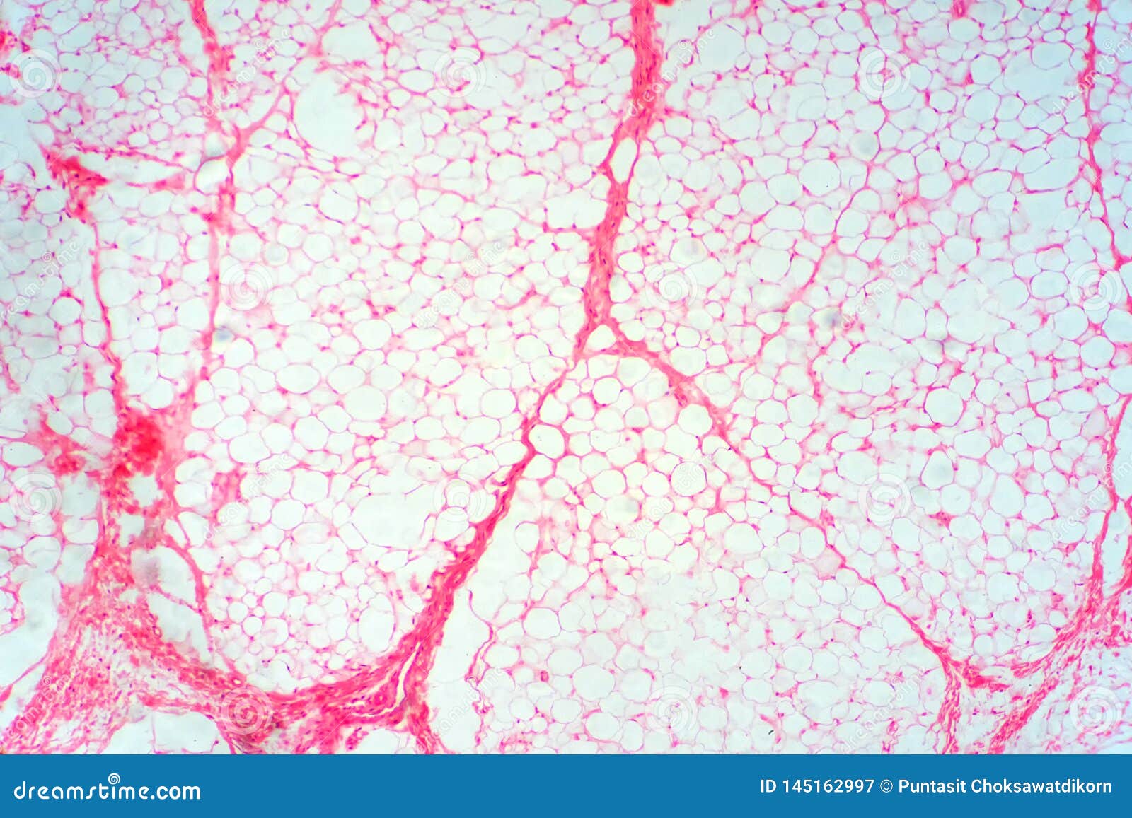 Human Fat Body Tissue Under Microscope View Stock Image - Image of ...