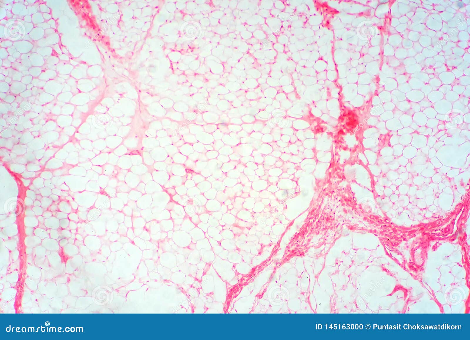 Human Fat Body Tissue Under Microscope View Stock Photo - Image of food ...