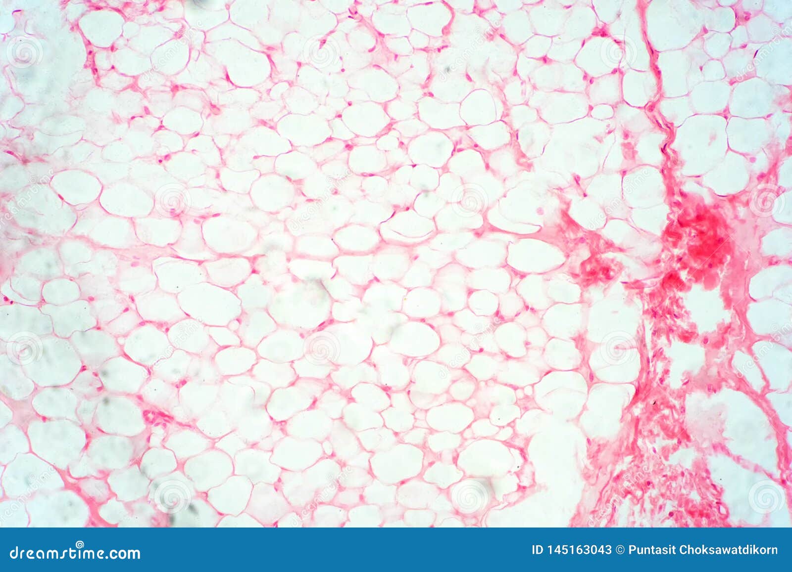 Human Fat Body Tissue Under Microscope View Stock Image - Image of ...
