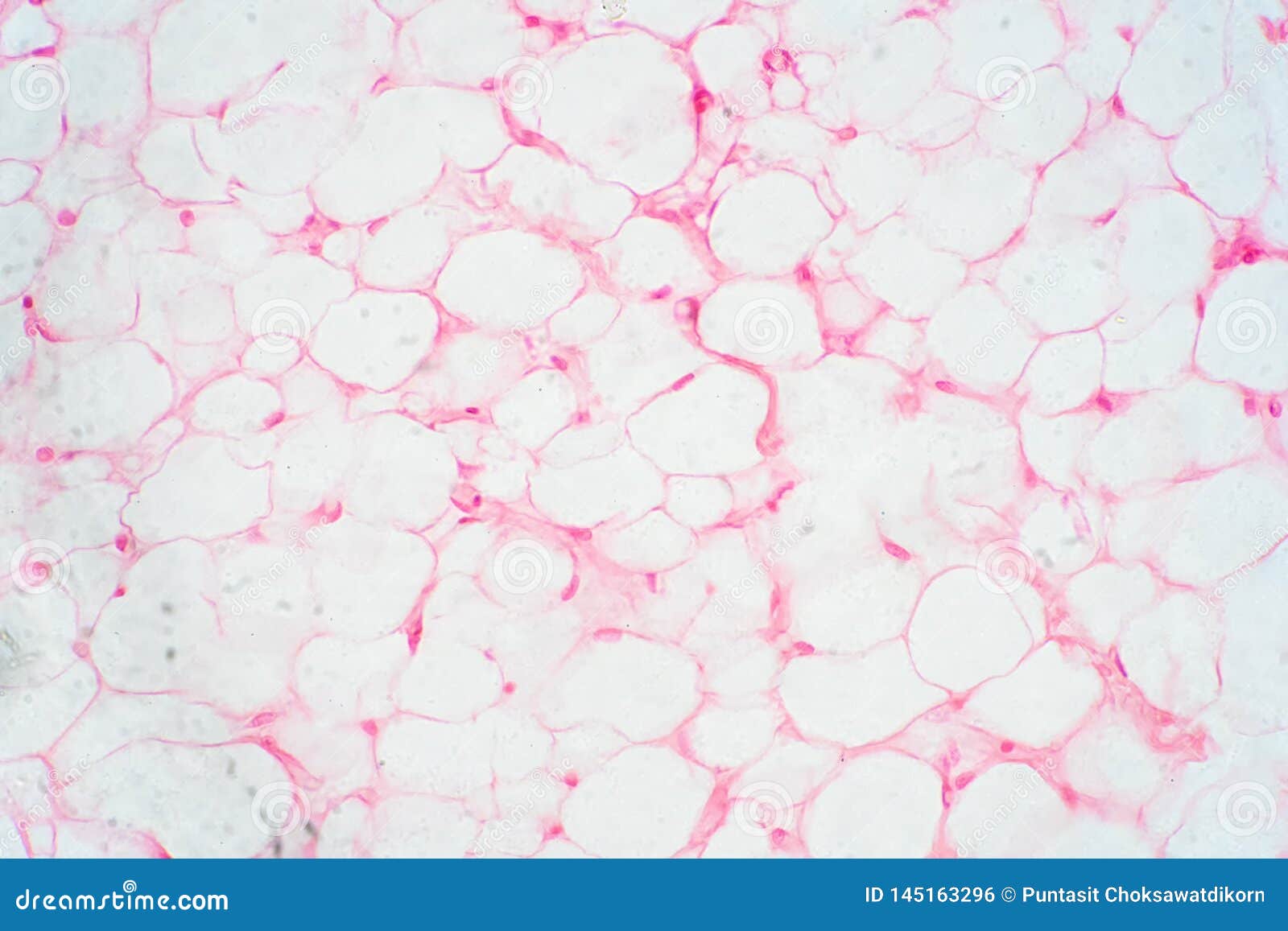 Human Fat Body Tissue Under Microscope View Stock Photo - Image of ...
