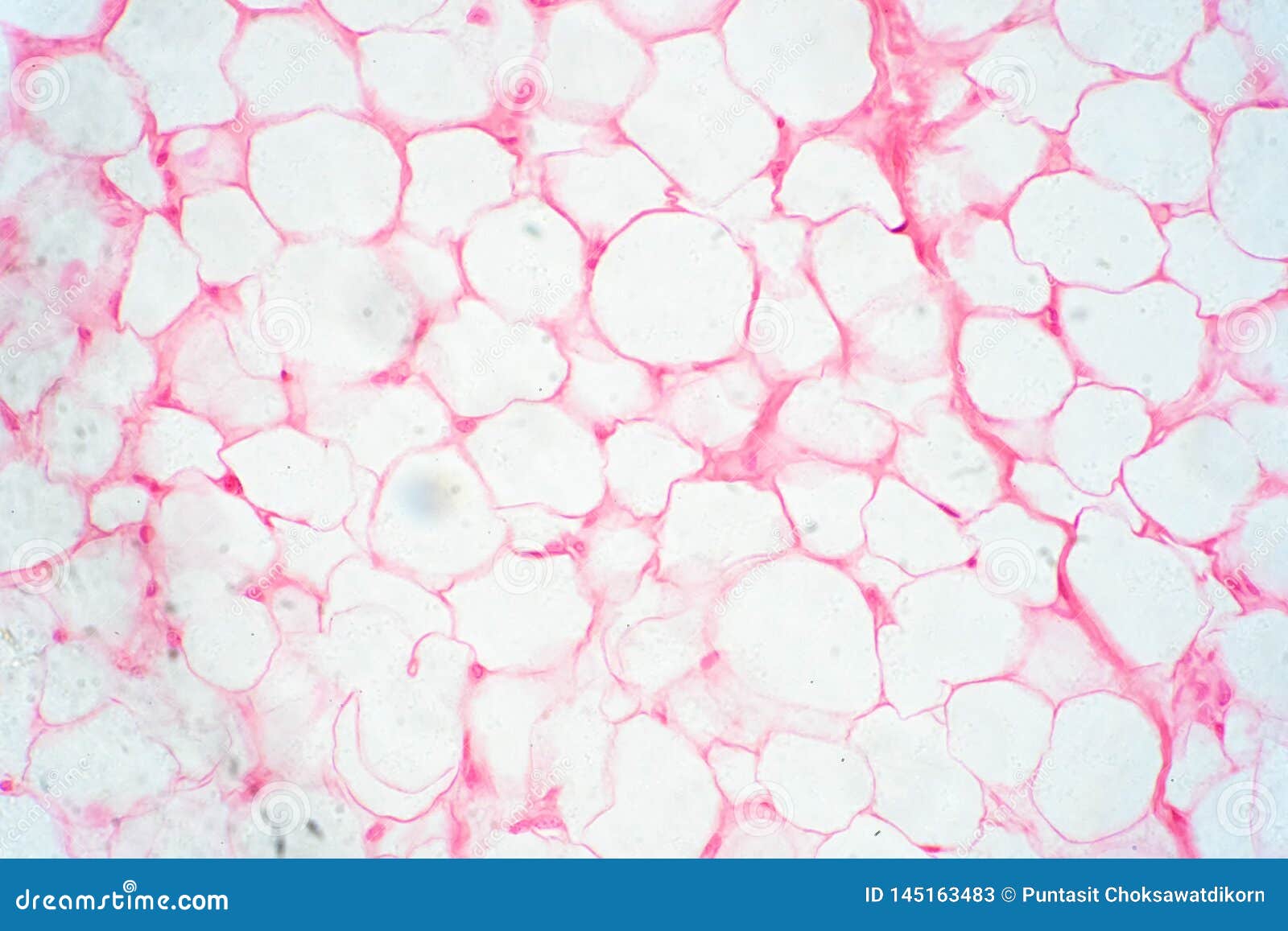 Human Fat Body Tissue Under Microscope View Stock Image - Image of ...